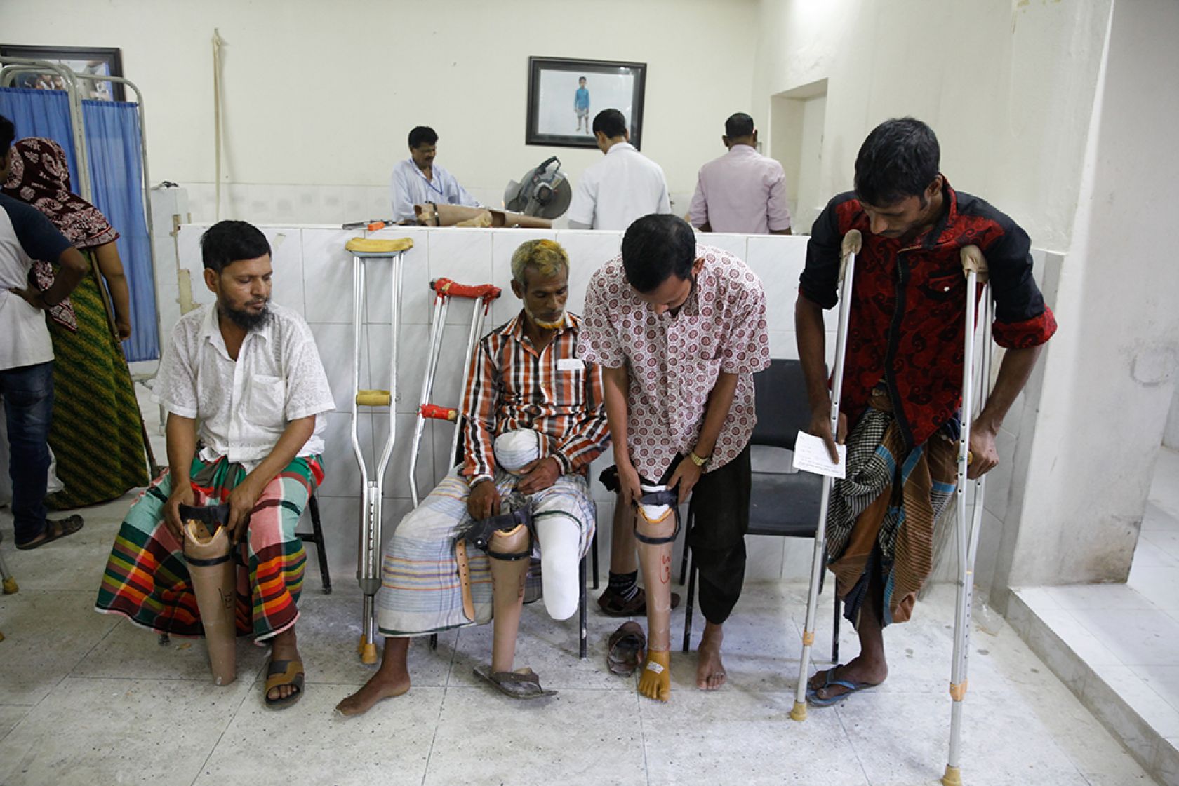 The impacts of lower limb amputation on Bangladeshi citizens, News, La ...