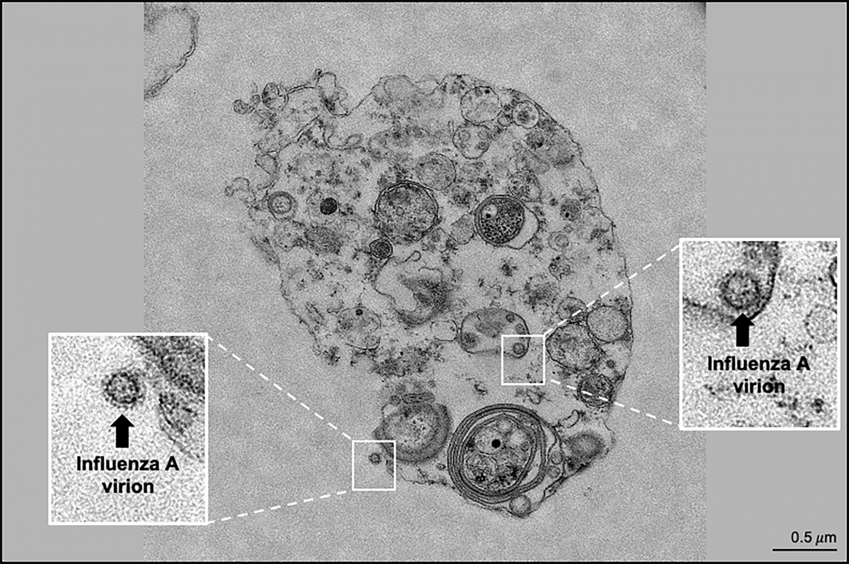 How influenza virus hijacks our defence, News, La Trobe University