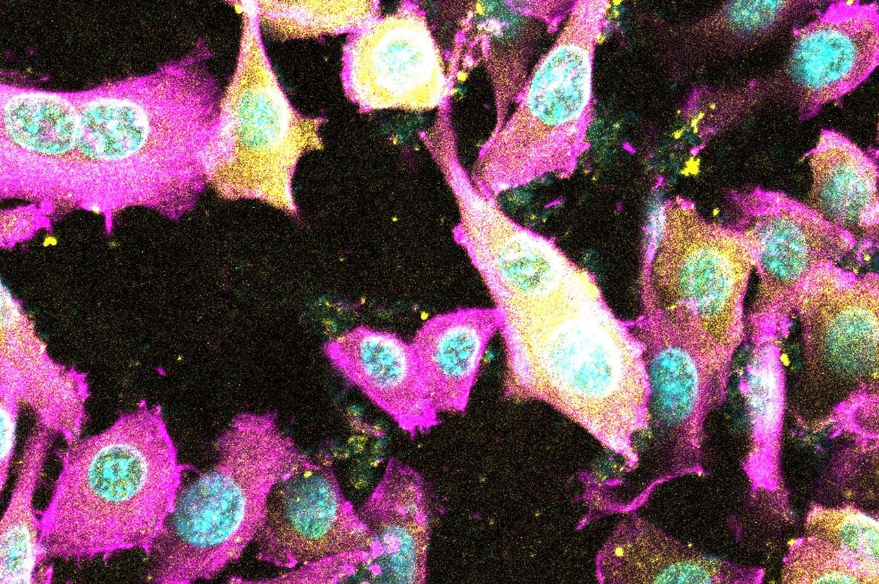 La Trobe Institute for Molecular Science (LIMS), La Trobe University