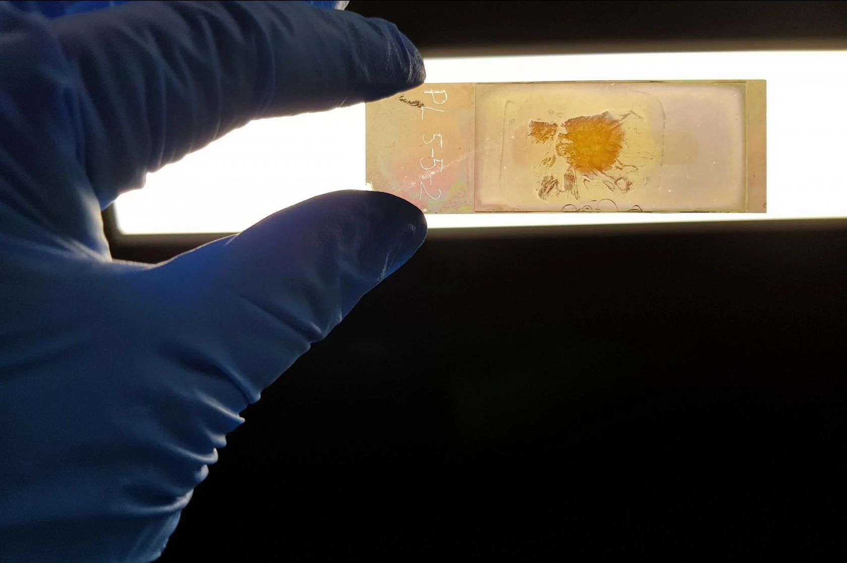 Smart microscope slides detect cancer | Mirage News